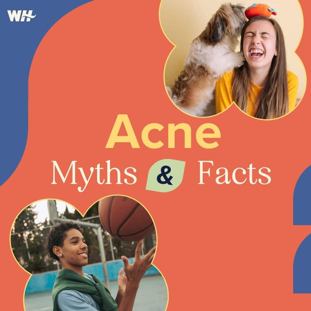 Acné: ¿Qué es normal y cuándo debería aparecer? Ayuda experta - Winona ...